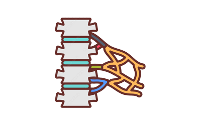 [PPT] Brachial Plexus PPT Slide (Presentation)