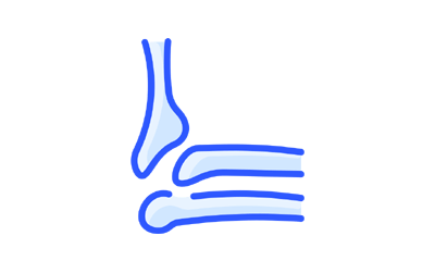 [PPT] Radius Bone PPT Slide (Presentation)